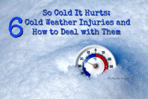 6 Cold Weather Injuries and How to Deal with Them - The Organic Prepper