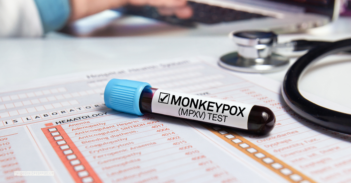 What Preppers Need to Know About Monkeypox - The Organic Prepper